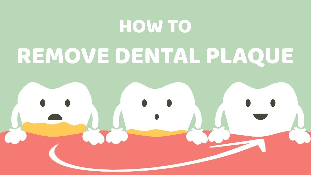 Dental Plaque Removal & Treatment Bangalore, India